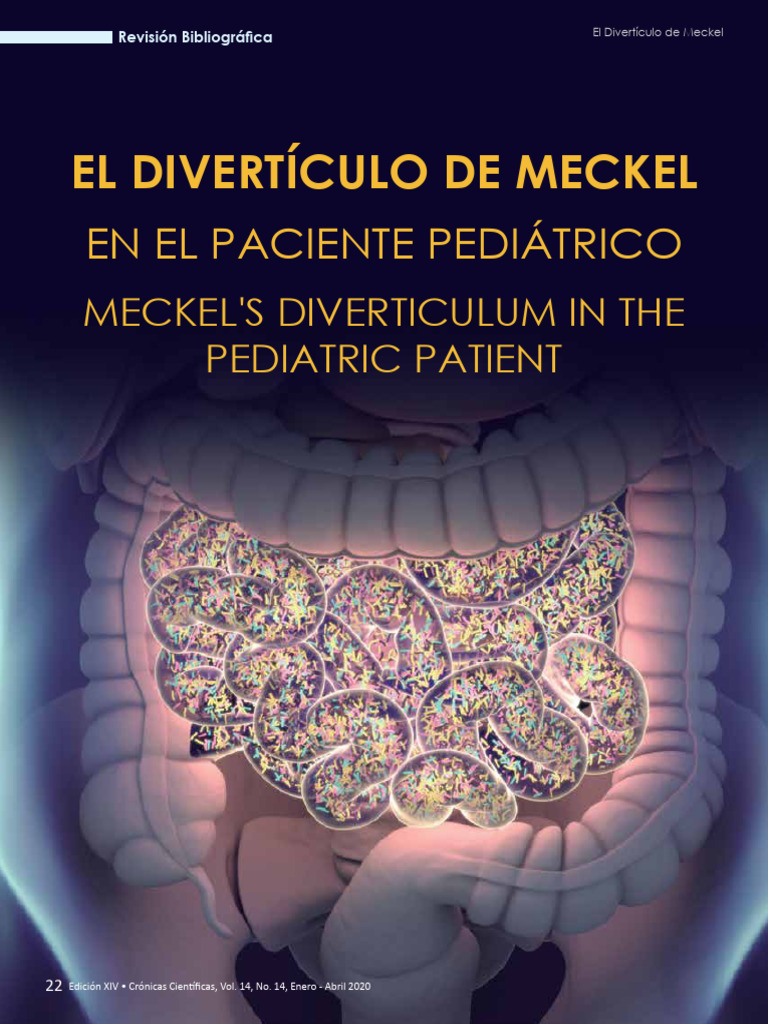 El Divertículo de Meckel en El Paciente Pediátrico | PDF