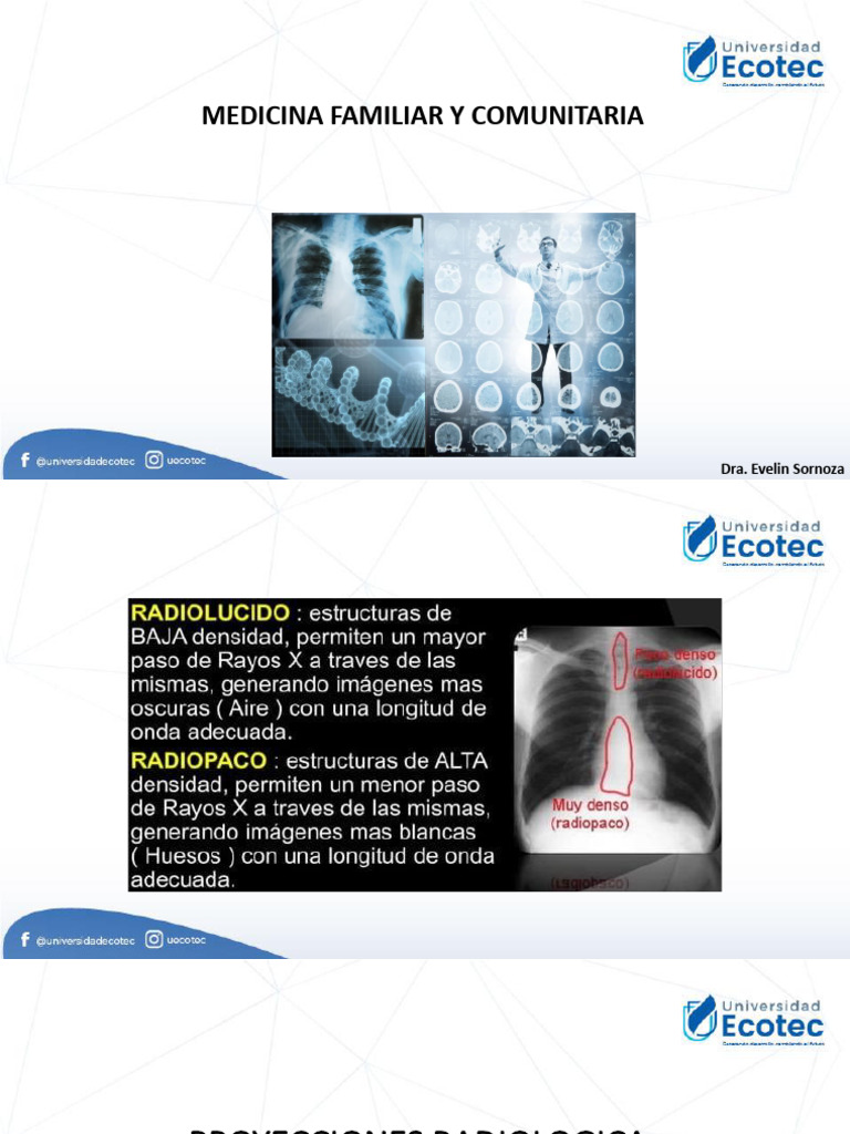 Clase A Unidad IV Valoracion Radiografia de Torax y Abdomen | PDF