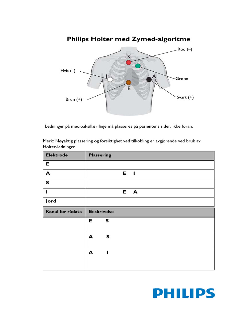 Holter Quick Reference NO | PDF