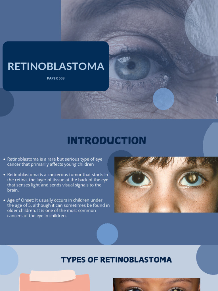 RETINOBLASTOMA | PDF