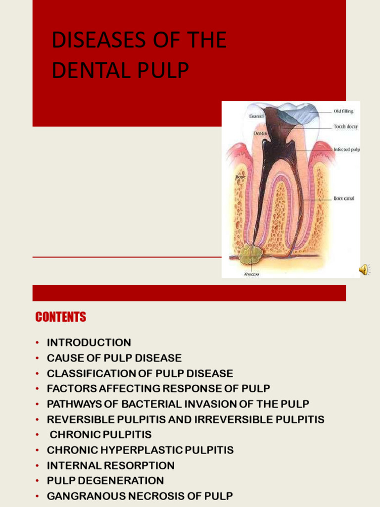 Diseasesof The Pulp | PDF