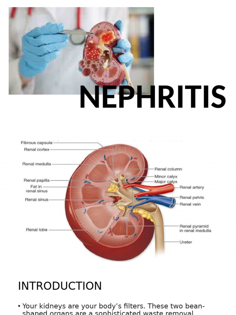 Nephritis 1 | PDF