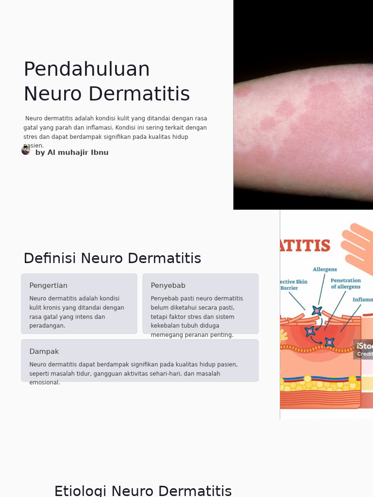 Pendahuluan Neuro Dermatitis | PDF