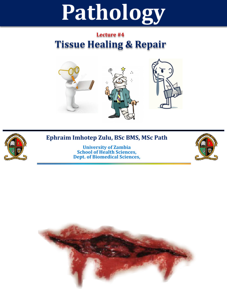 PATHOLOGY - 04 - Healing Repair | PDF | Scar | Wound Healing