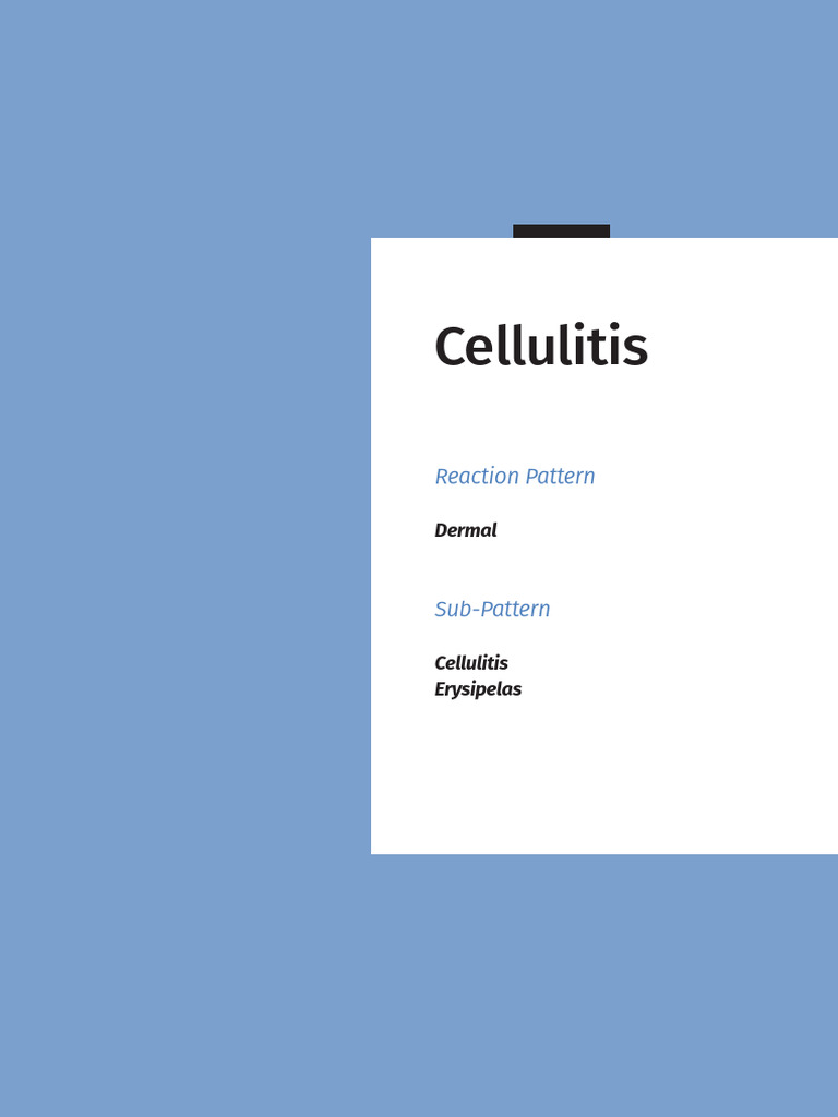 Infections - Bacterial - Cellulitis: Erysipelas | PDF