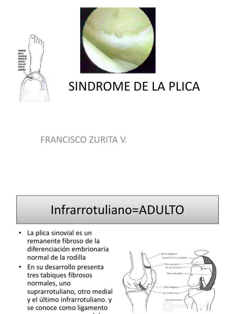 Síndrome de Plica Sinovial en Rodilla | PDF | Relaciones personales ...