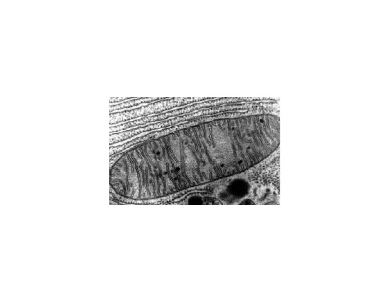 Electron Micrograph - Mitochondrion | PDF