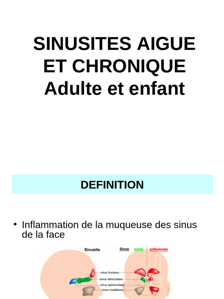 Sinusite | PDF