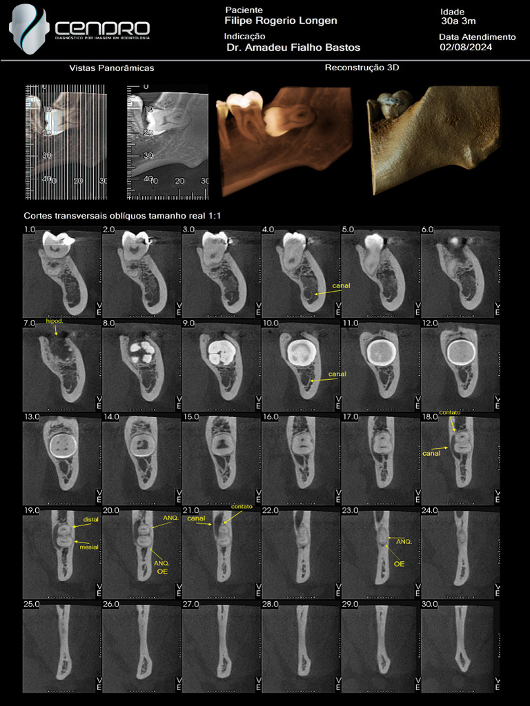 tomografia antiga | PDF