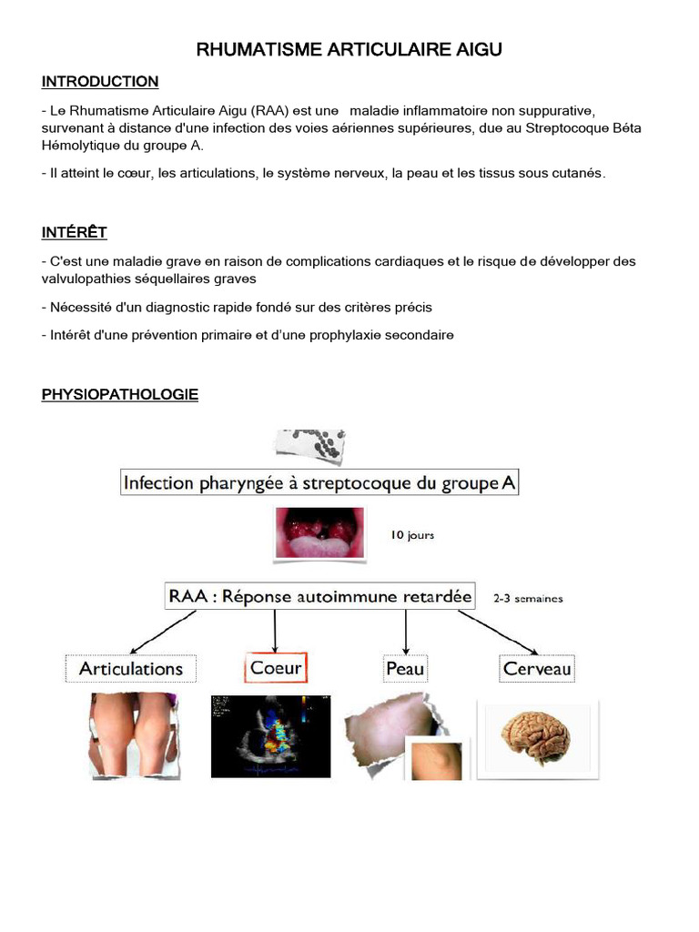 Rhumatisme Articulaire Aigu | PDF