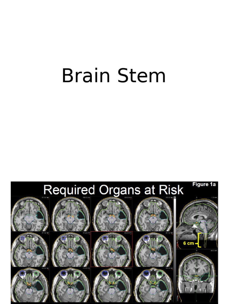 Brain Stem | PDF