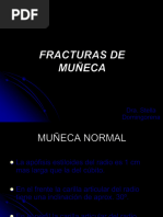 Clasificación de Fernández para Fracturas de Radio | PDF