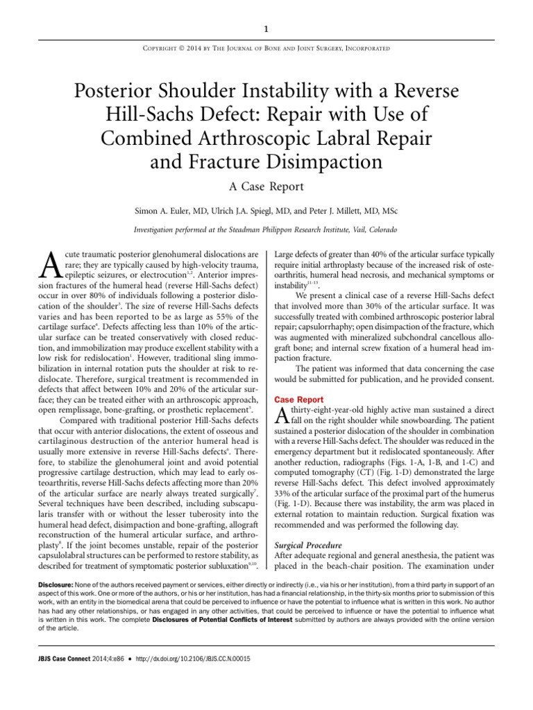 Posterior Shoulder Instability Reverse Hill Sachs Defect Repair ...