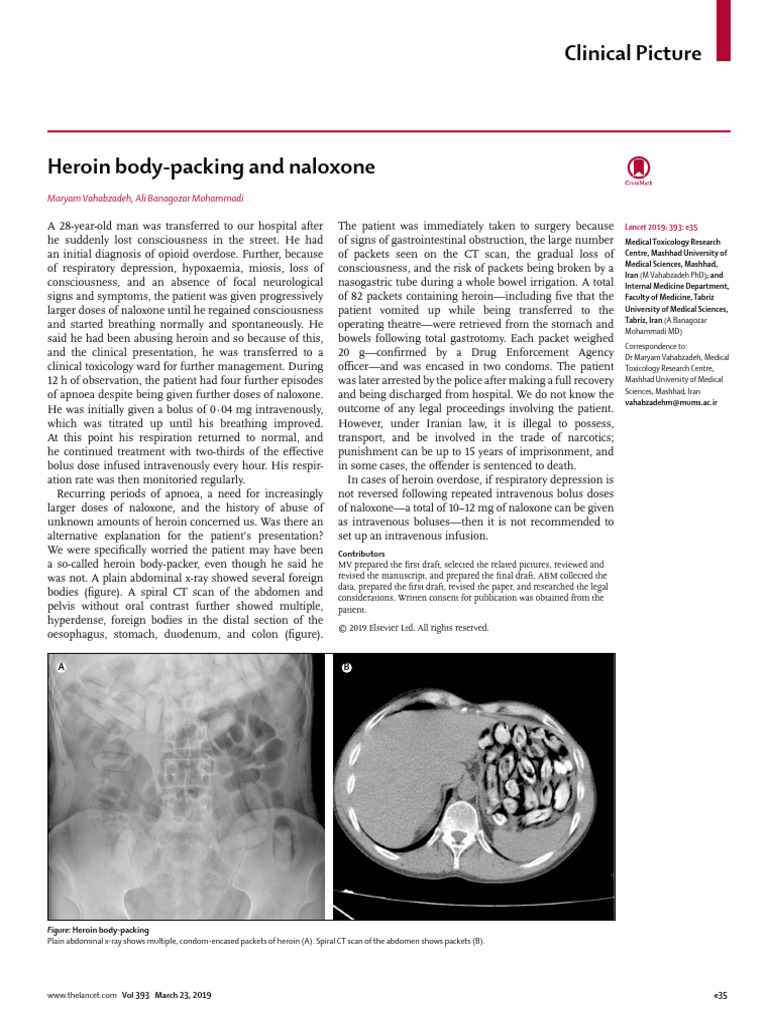 Body Packer Heroina y Naloxona 2019 | PDF