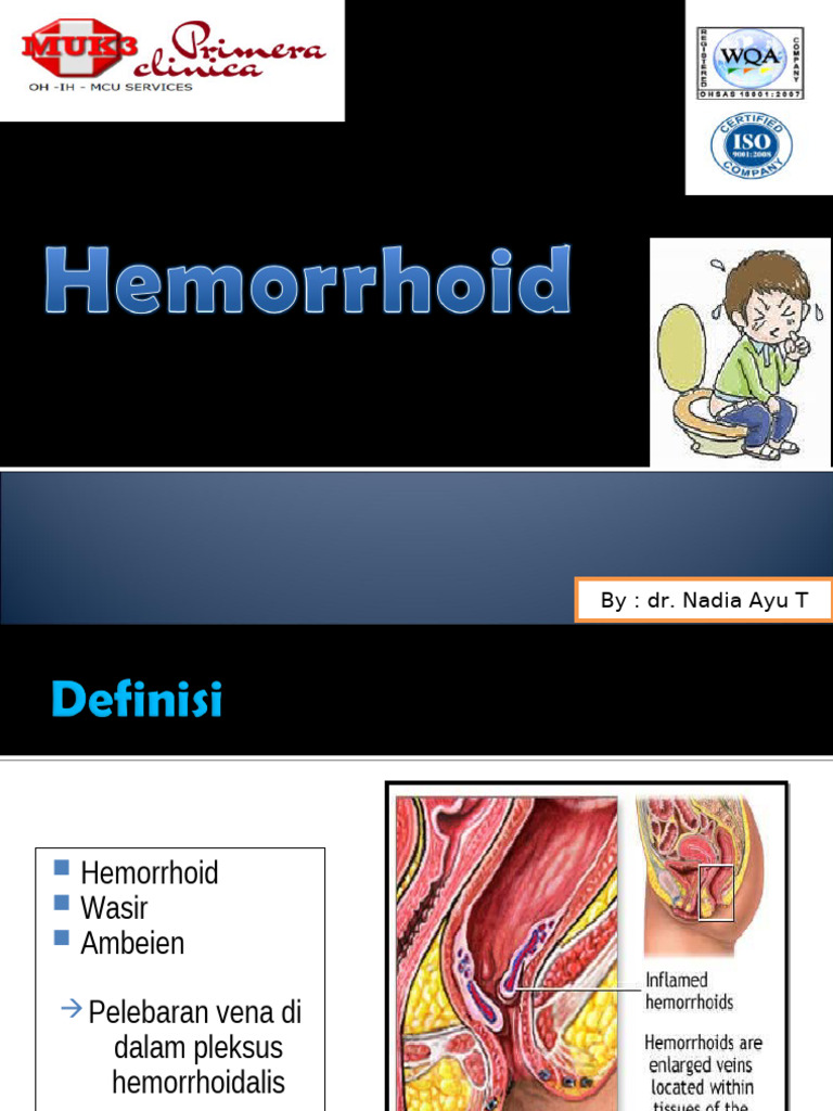 Hemoroid | PDF