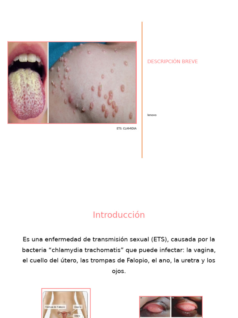 Diapositiva Clamidia | PDF