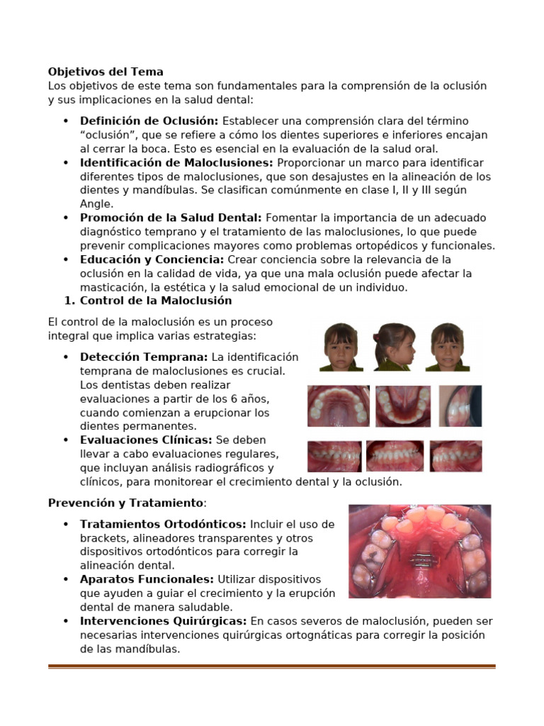 Esi 2 | PDF