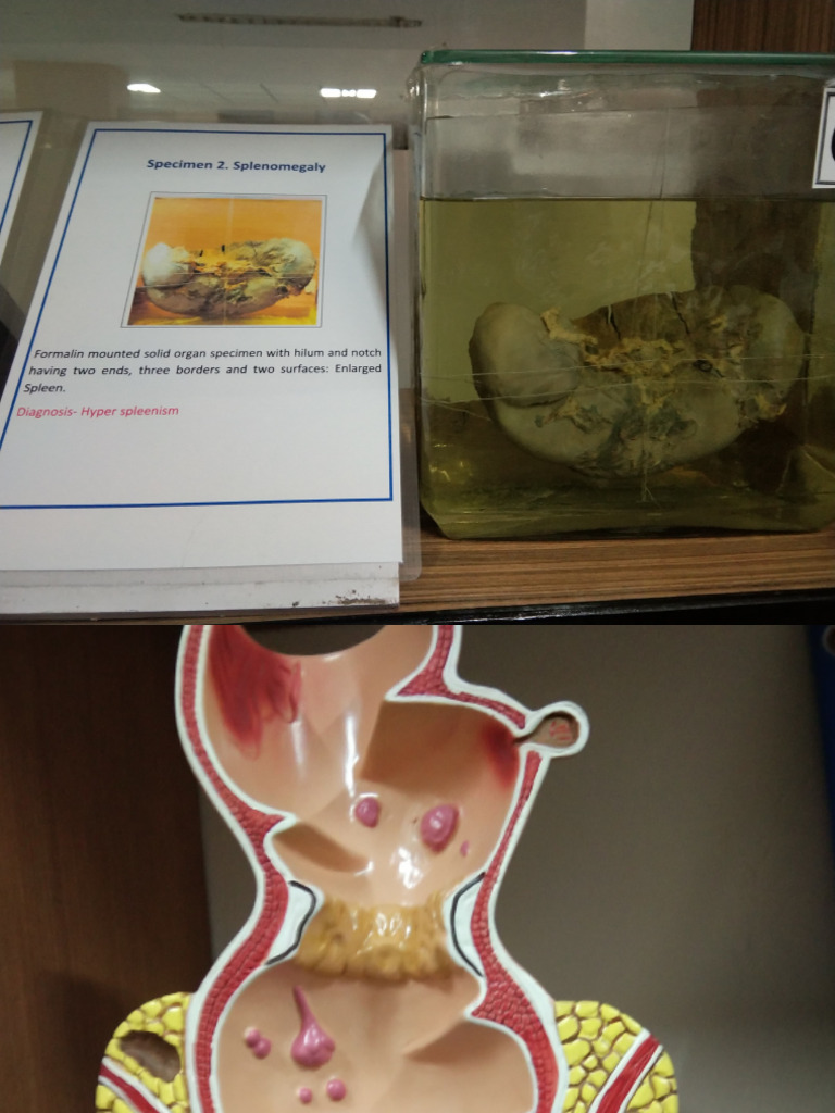 Surgery Specimens 1 | PDF