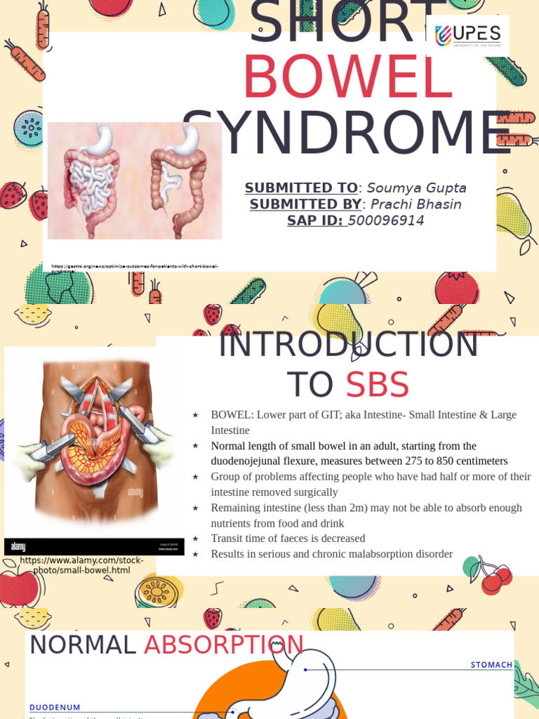 Short Bowel Syndrome (Sbs PPT) and Nutrition | PDF