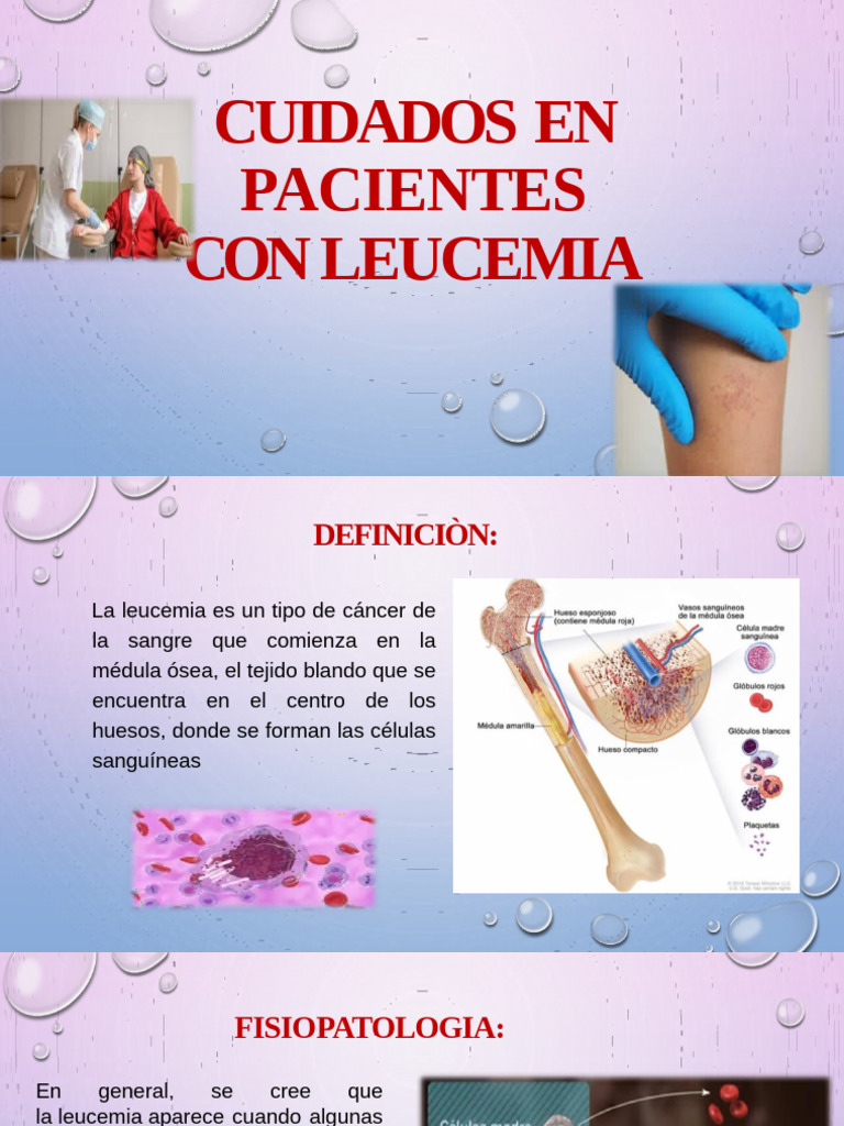 Leucemia Cuidados ?? | PDF