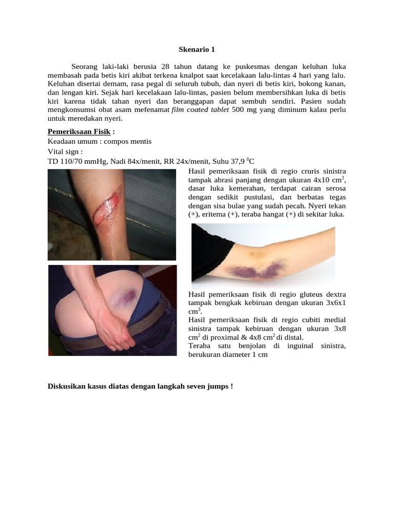 Skenario 1 BLOK 7 | PDF