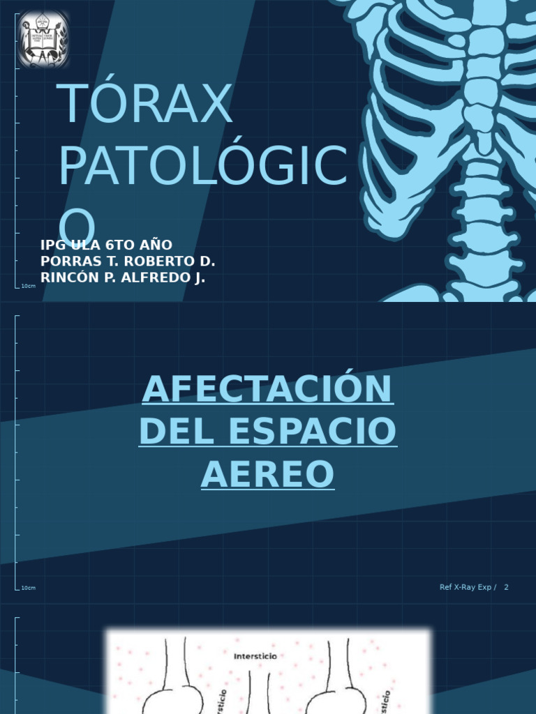 Tórax Patológico 2023 | PDF