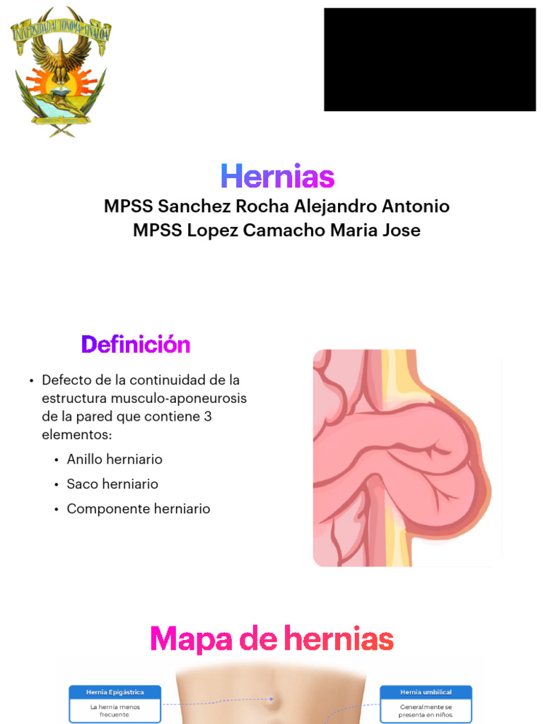 Hernias | PDF