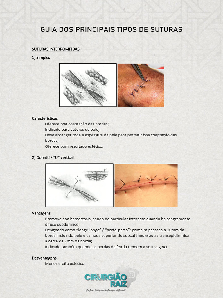 TIPOS DE SUTURAS - CIRURGIAO RAIZ | PDF