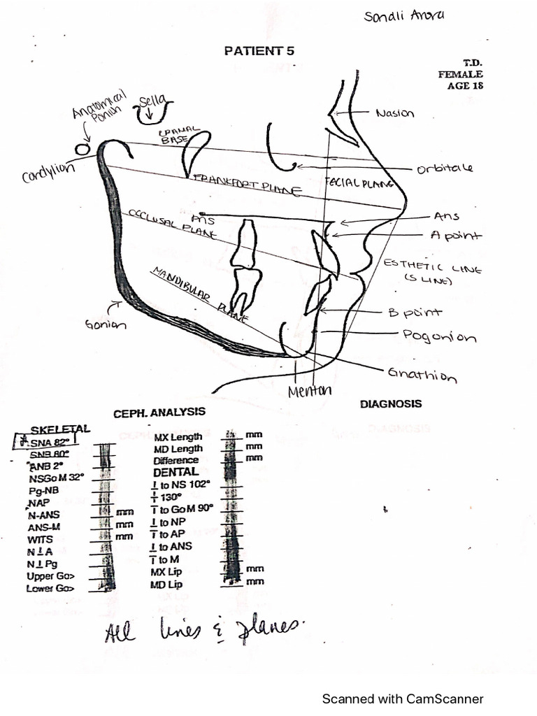 Tracing | PDF