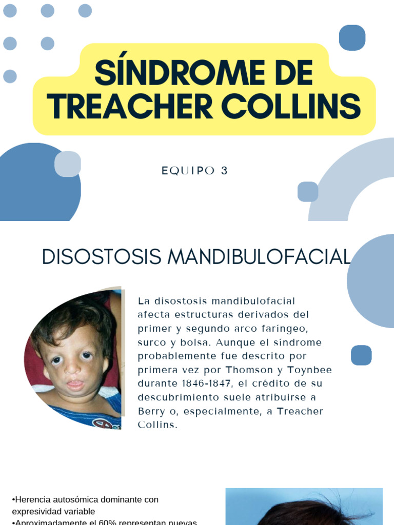 Treacher Collins | PDF