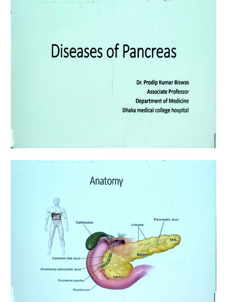 Acute Pancreatitis (2) @medicine | PDF
