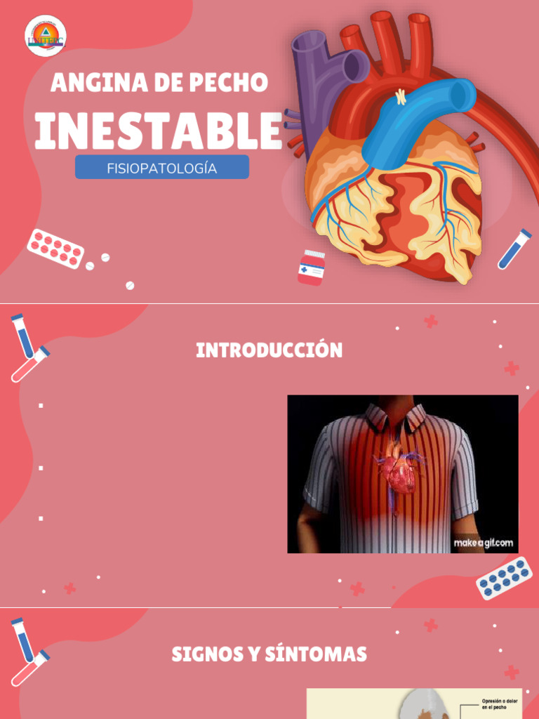 Angina Inestable | PDF