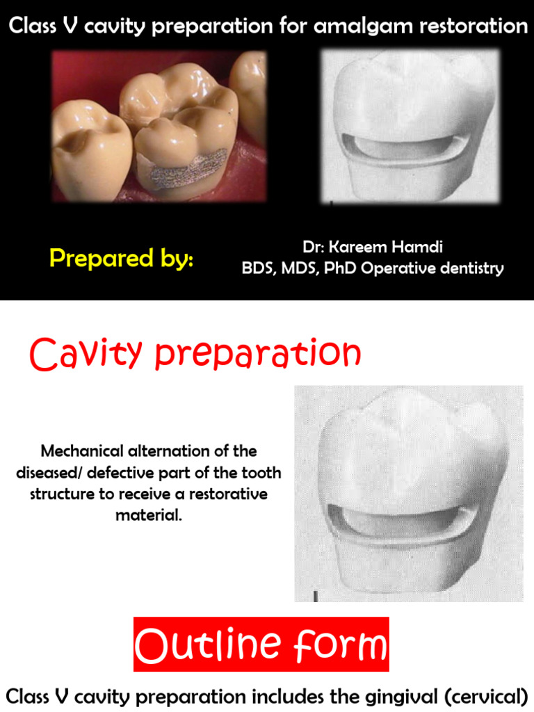 Operative Lec8 | PDF