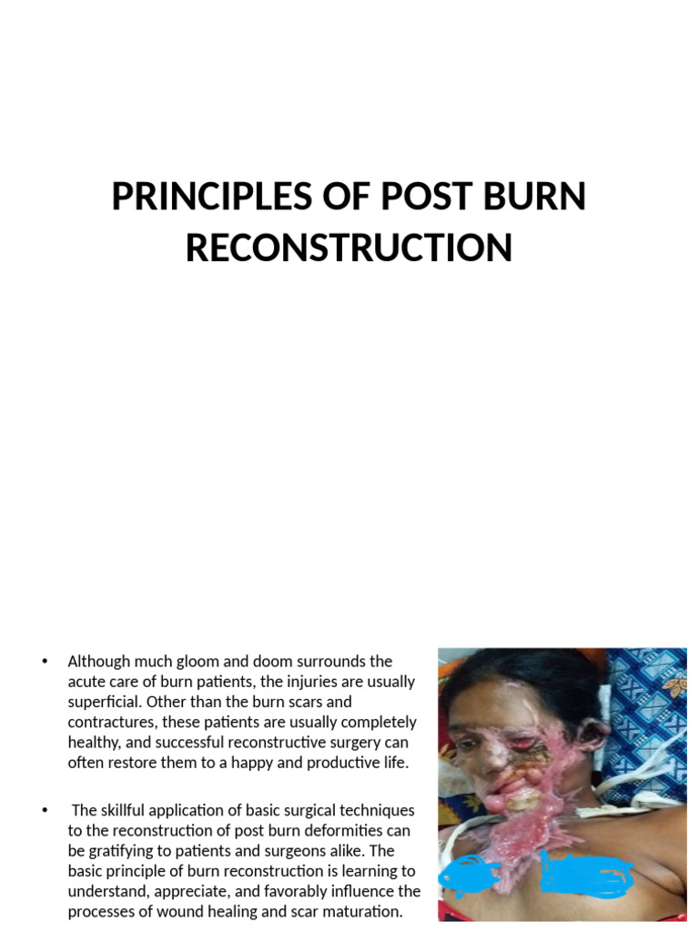 Principles of Post Burn Reconstruction | PDF