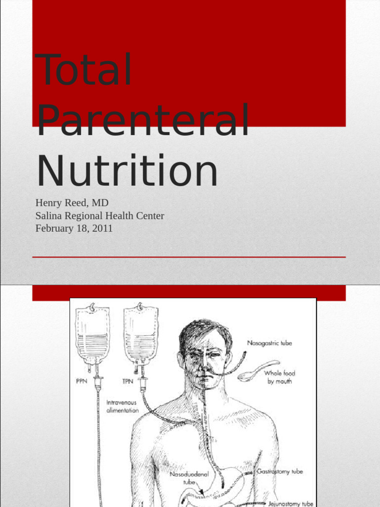 Total Parenteral Nutrition | PDF