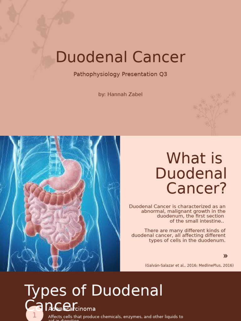 Duodenal Cancer Q3 Presentation | PDF