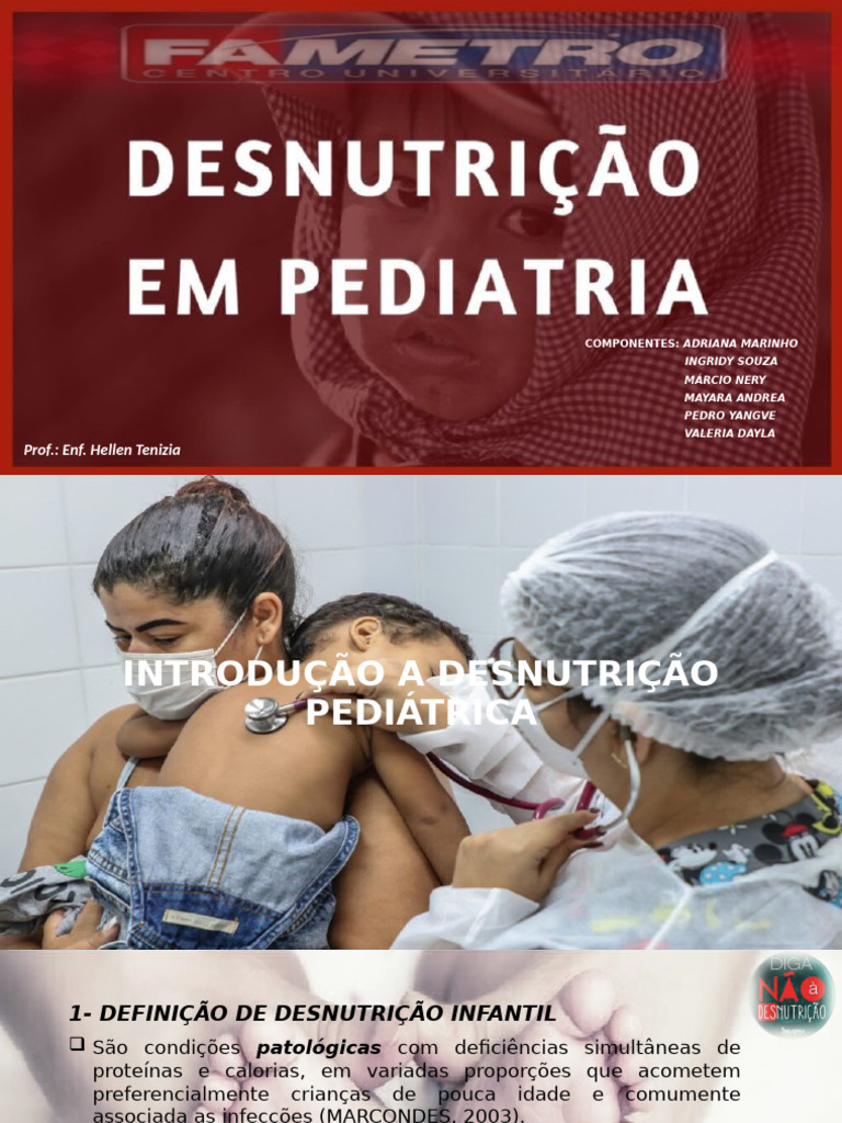 Desnutriçao em Pediatria | PDF