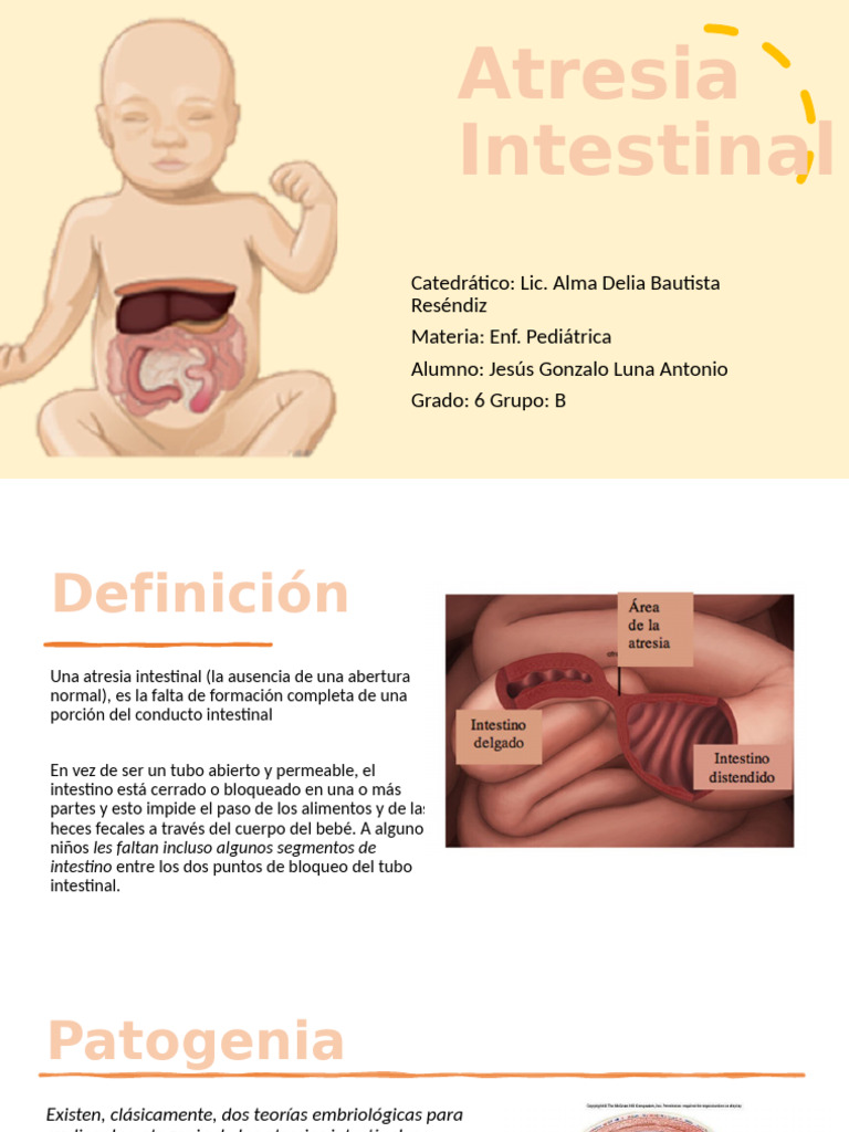 Atresia Intestinal | PDF