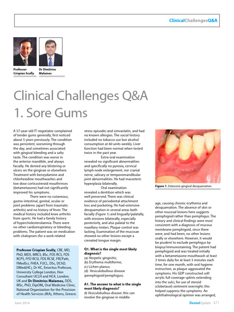 Clinical Challenges Q&A 1. Sore Gums | PDF