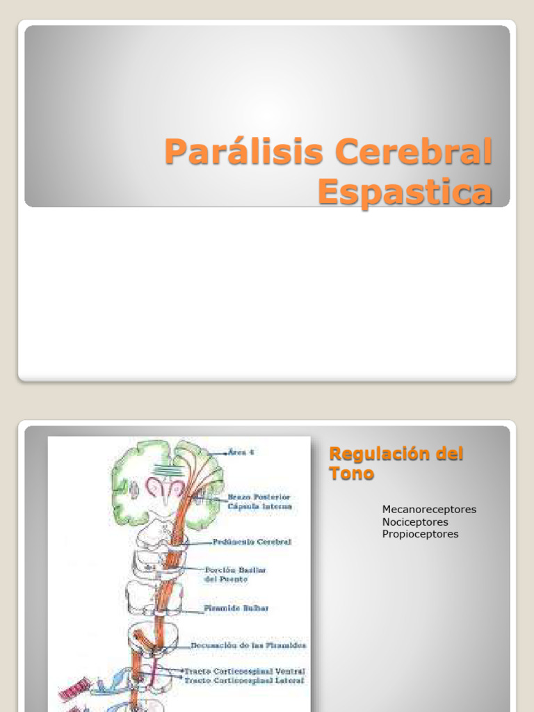 Paralisis Cerebral Espastica | PDF