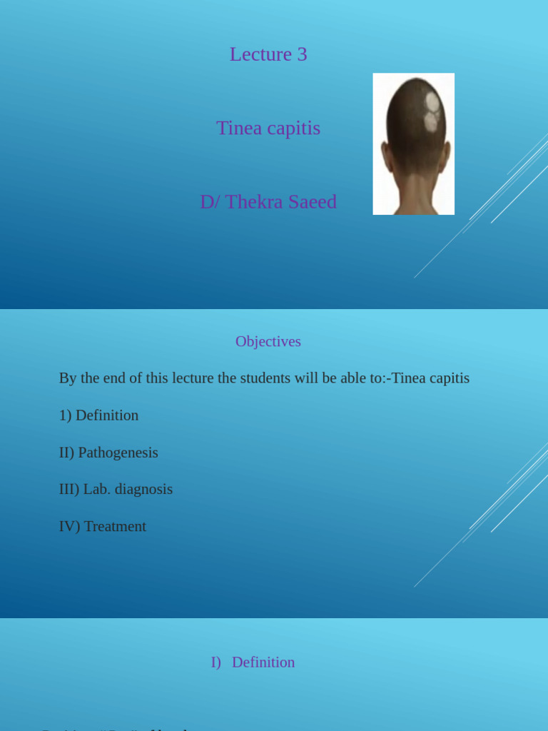 Tinea Capitis | PDF