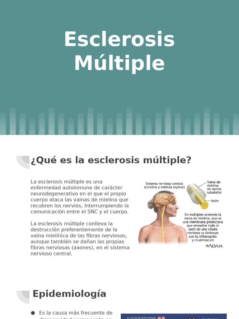 ESCLEROSIS MULTIPLE ORIGINAL | PDF