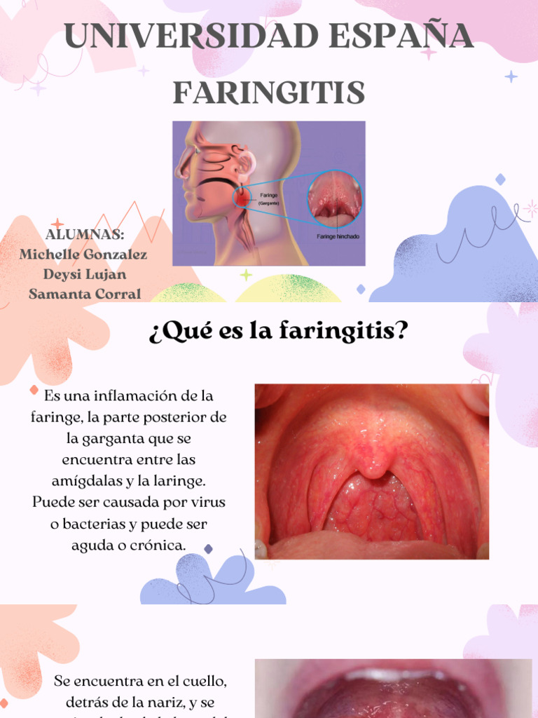 ¿Qué es la faringitis | PDF