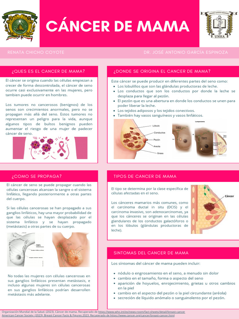 Cancer de Mama | PDF