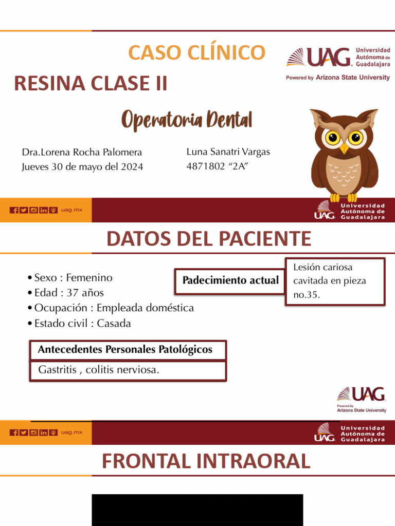 Caso Clínico Operatoria | PDF