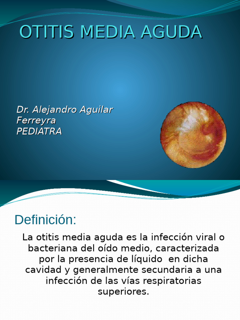 Otitis Media Aguda | PDF