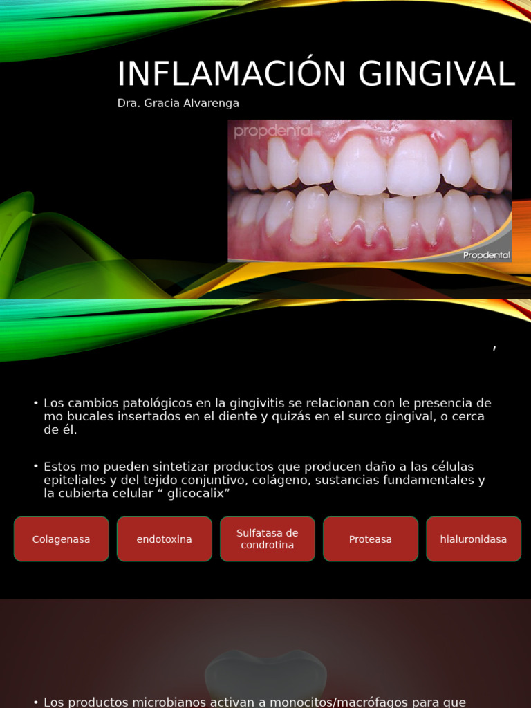 Inflamación gingival | PDF