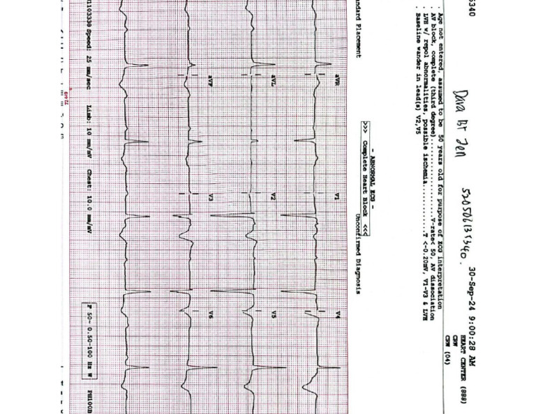 ecg1 | PDF