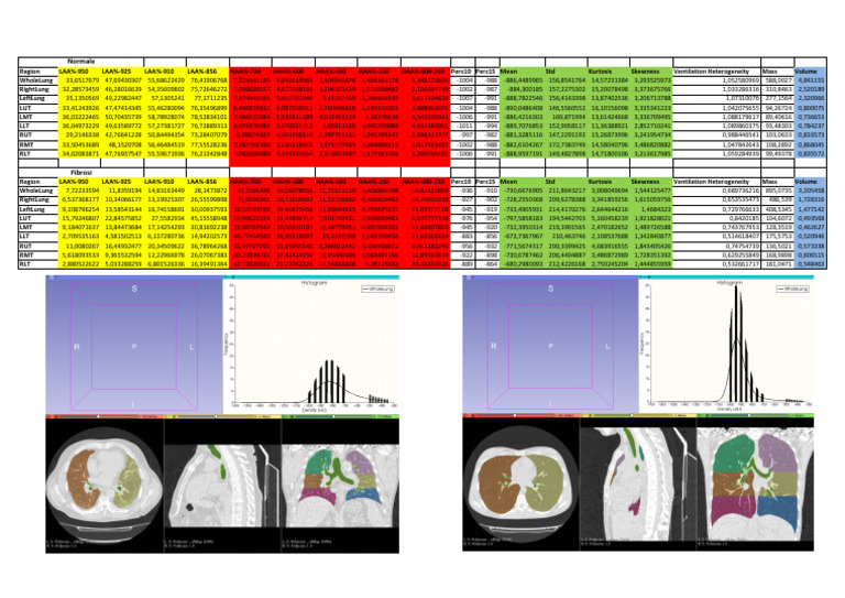 Numeric Analysis | PDF
