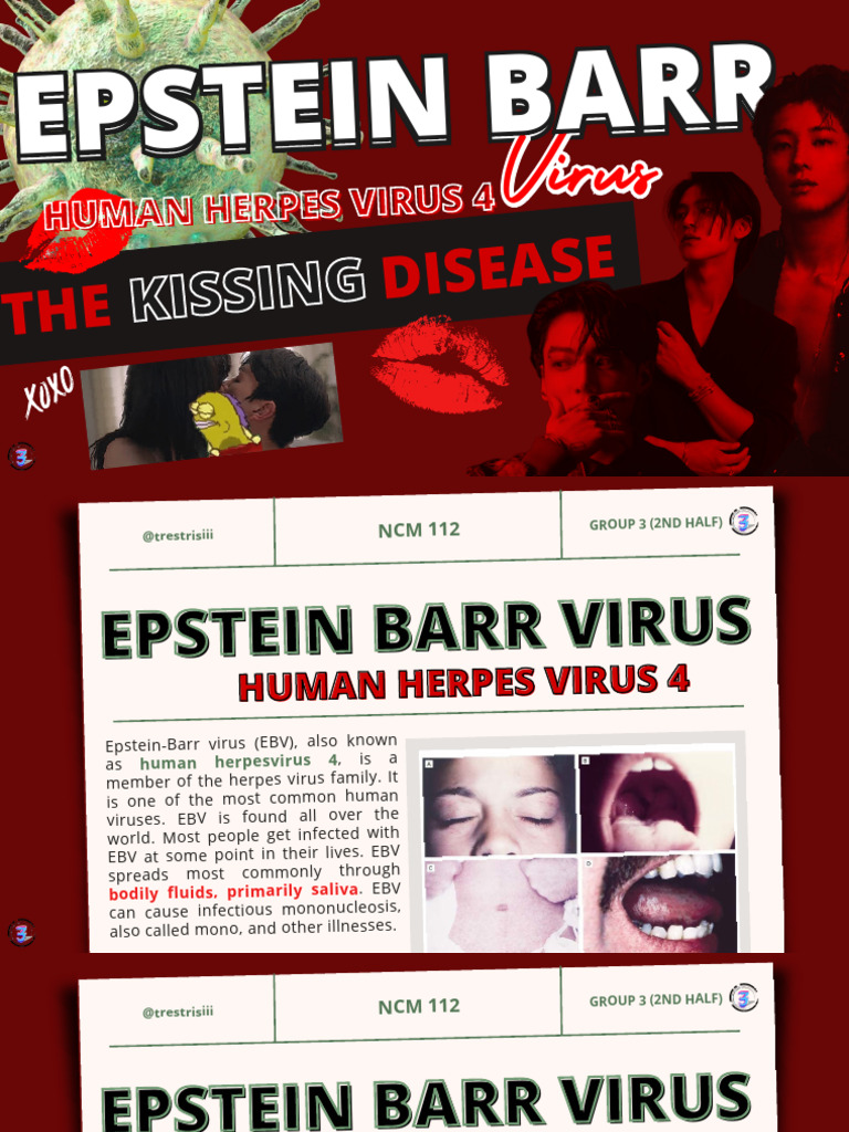 Epstein Barr | PDF